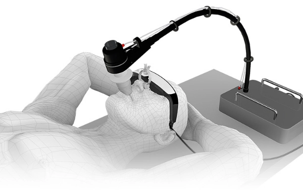 Unparalleled Precision in Radiation Therapy | SDX® System